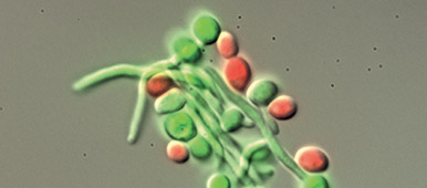 Les champignons, des tueurs trop souvent ignorés - Allez savoir!