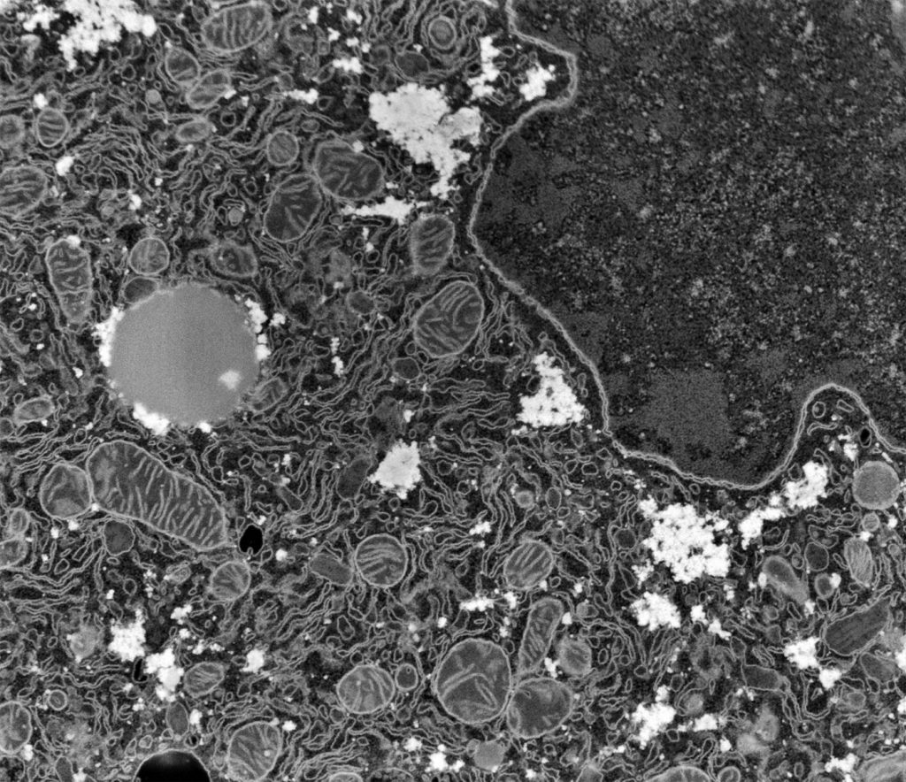 Mouse liver in FIB-SEM - Electron microscopy Facility University of ...