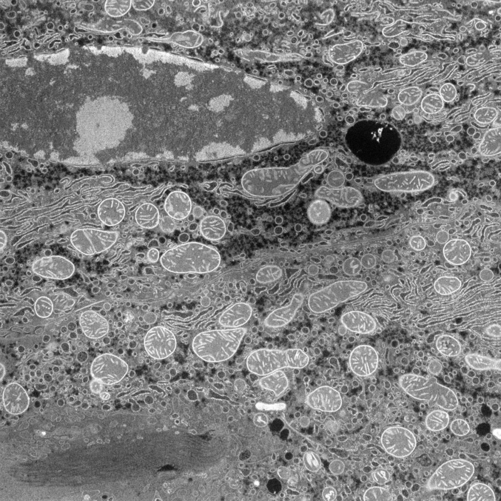 Mouse liver in FIB-SEM - Electron microscopy Facility University of ...