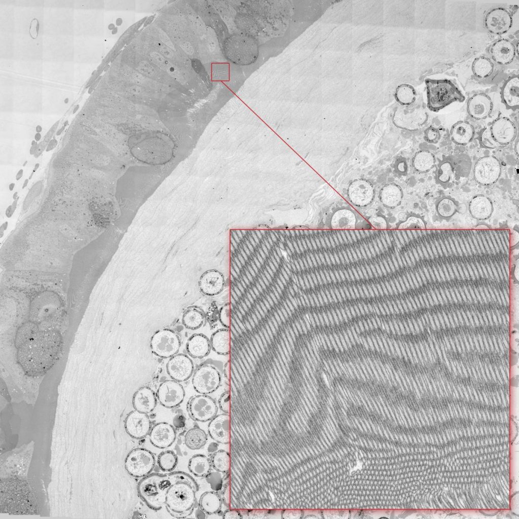 Examples in TEM high resolution - Electron microscopy Facility ...